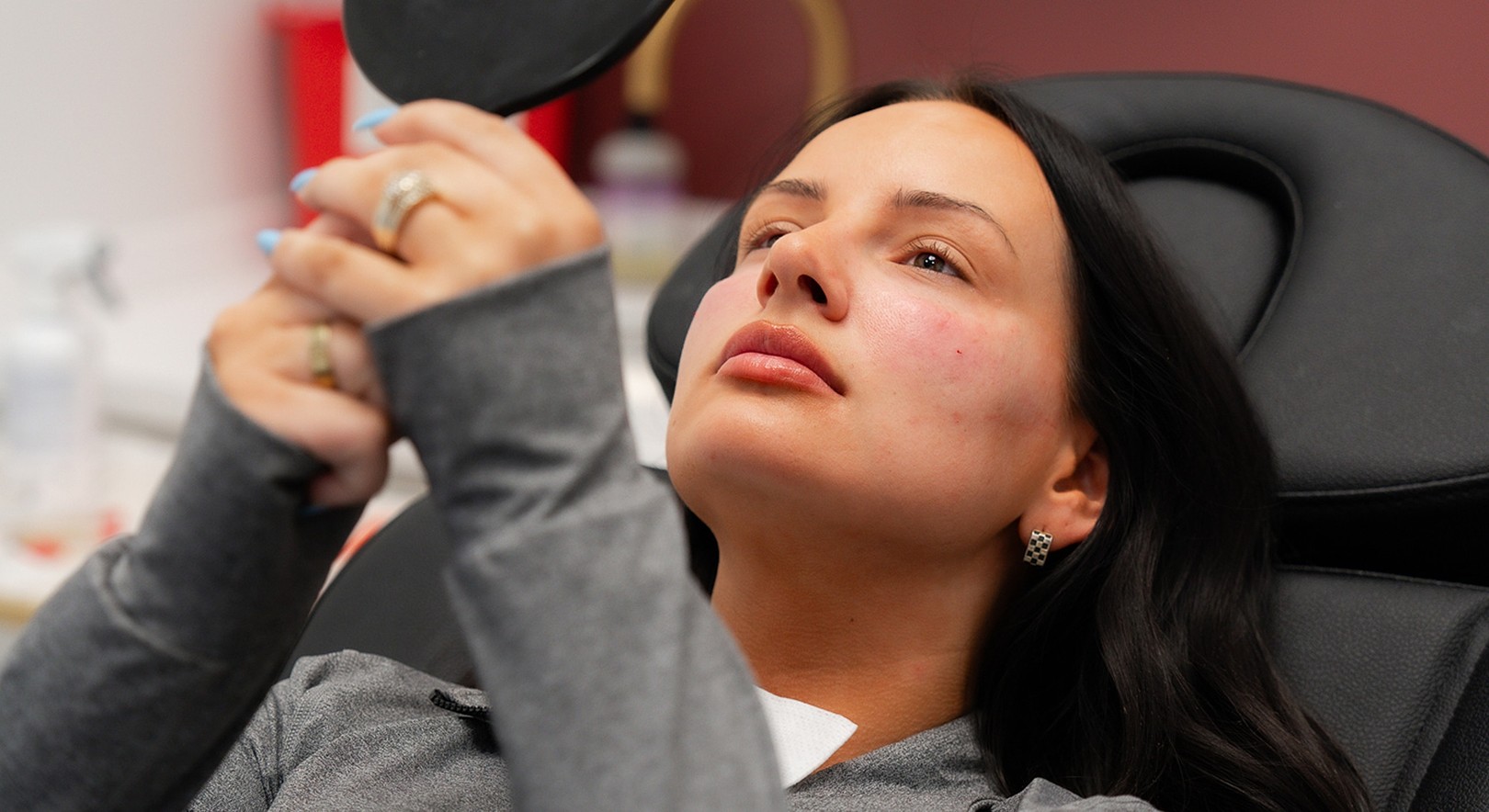 PRF EZ Gel St. Louis | St. Louis Skin Rejuvenation | Metro Medspa